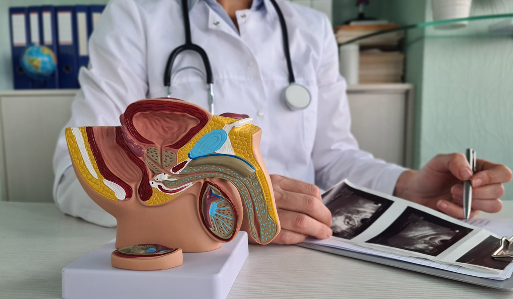 Cirugía de Próstata en CDMX - Dr.Rodrigo León Mar